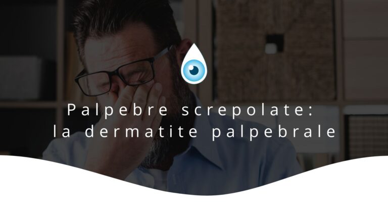 Palpebre screpolate: come riconoscere la dermatite palpebrale - Hylocchio